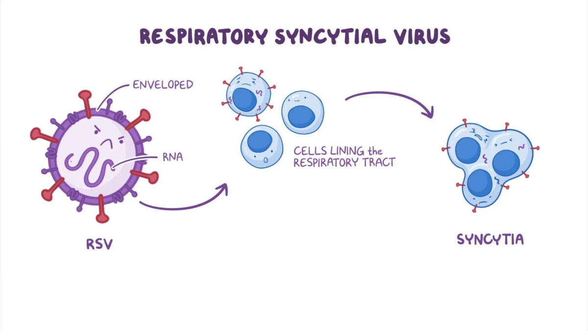 Texas Specialty Clinic What is respiratory syncytial virus? | Texas Speciality Clinic